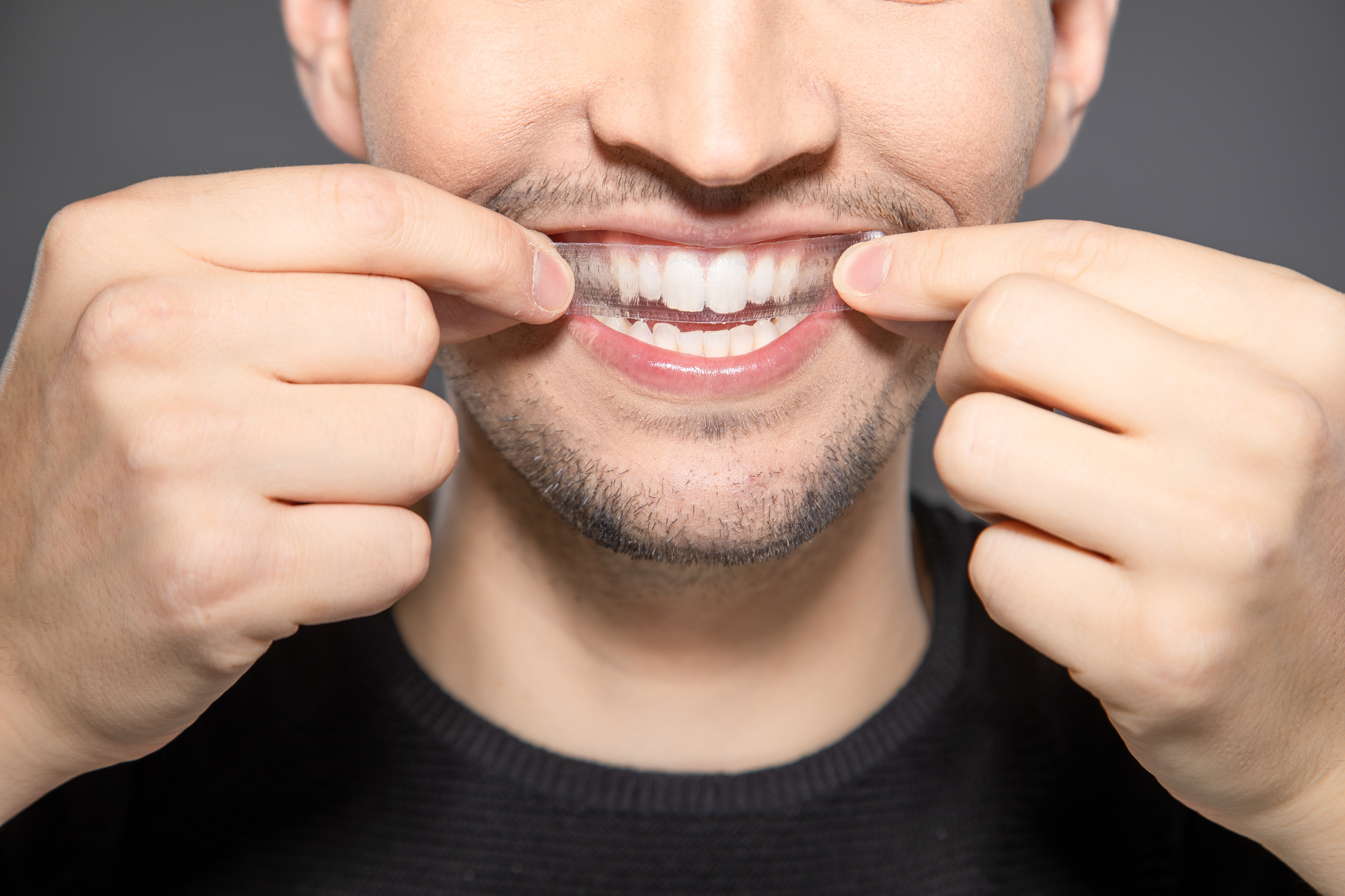 What Are The Different Types Of Teeth Whitening Options?